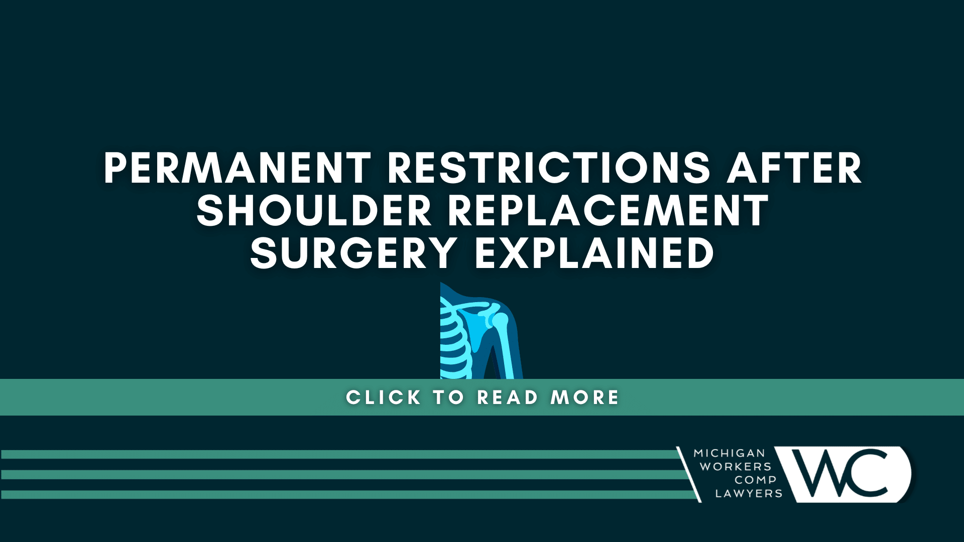 Permanent Restrictions After Shoulder Replacement Surgery